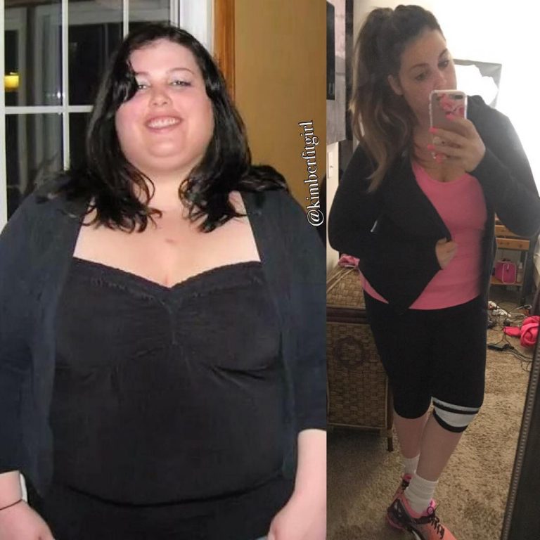 The Best 55 Weight Loss Transformations That You Will Have Ever Seen!