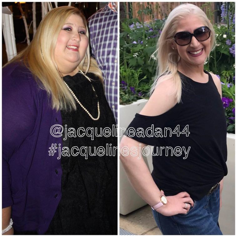 The Best 55 Weight Loss Transformations That You Will Have Ever Seen