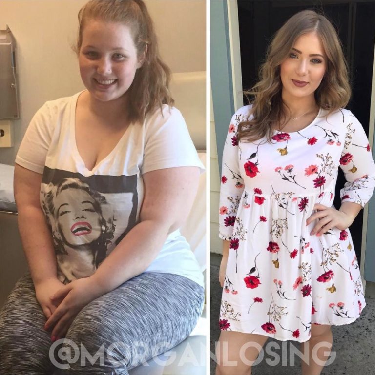 The Best 55 Weight Loss Transformations That You Will Have Ever Seen!